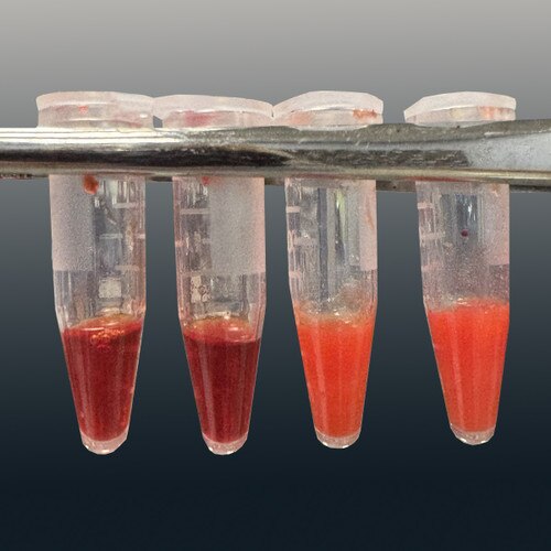 Simulated Blood Typing for Stem Cell Transplants Kit | Experiment | EDVOTEK